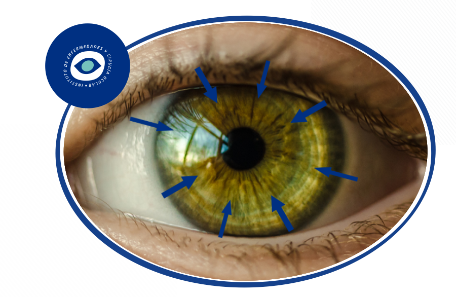 IECO – Instituto de Enfermedades y Cirugia Ocular